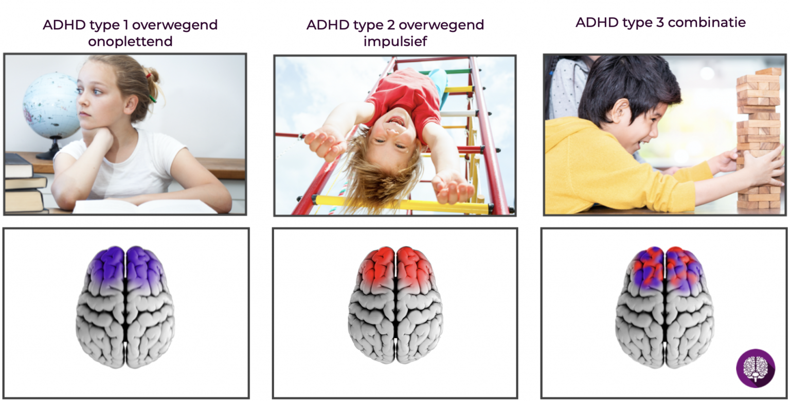 Brainmarker » ADHD
