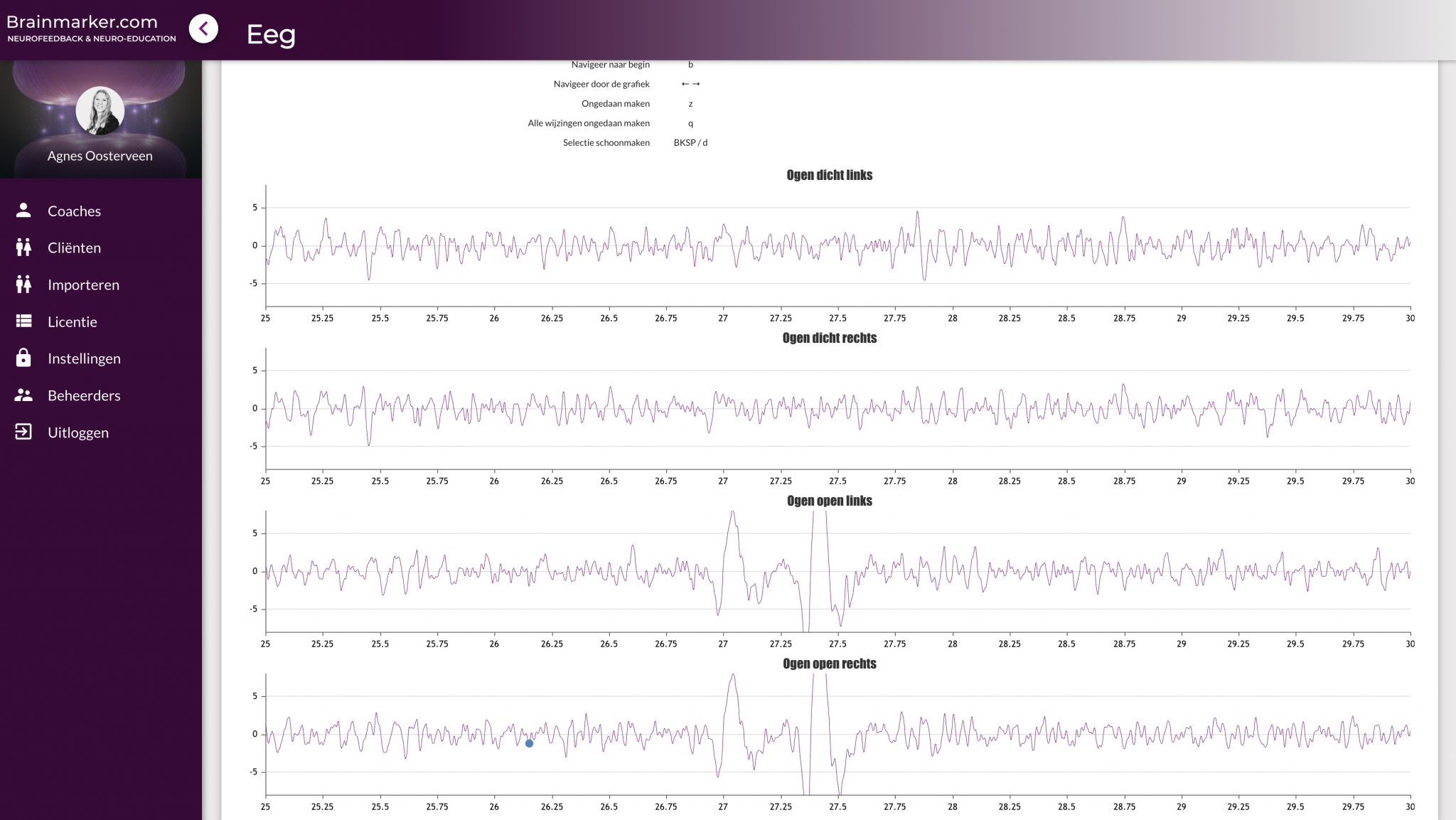 Brainmarker » Neurofeedback apparatuur